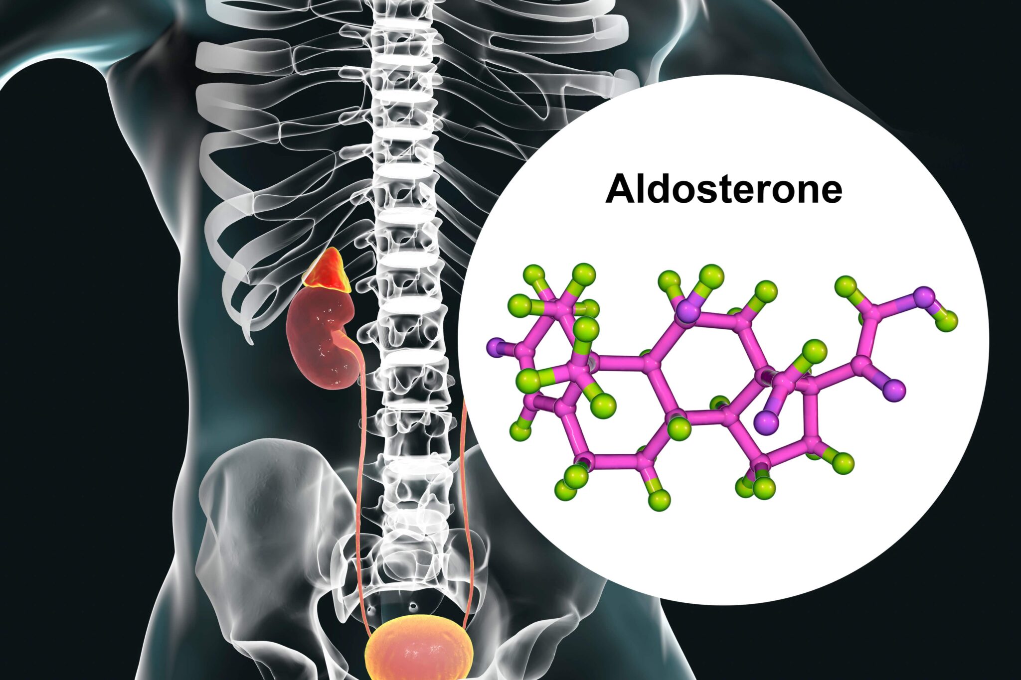 Primary Aldosteronism: Causes, Symptoms & Treatments